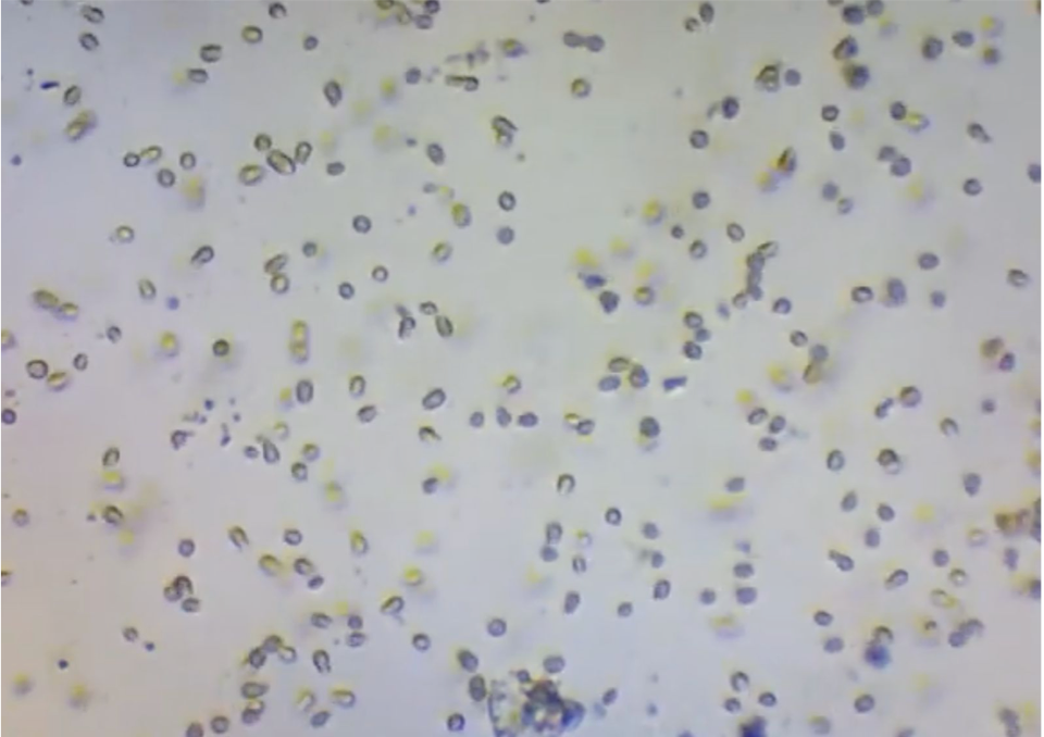 Saccharomyces Cerevisiae Slide